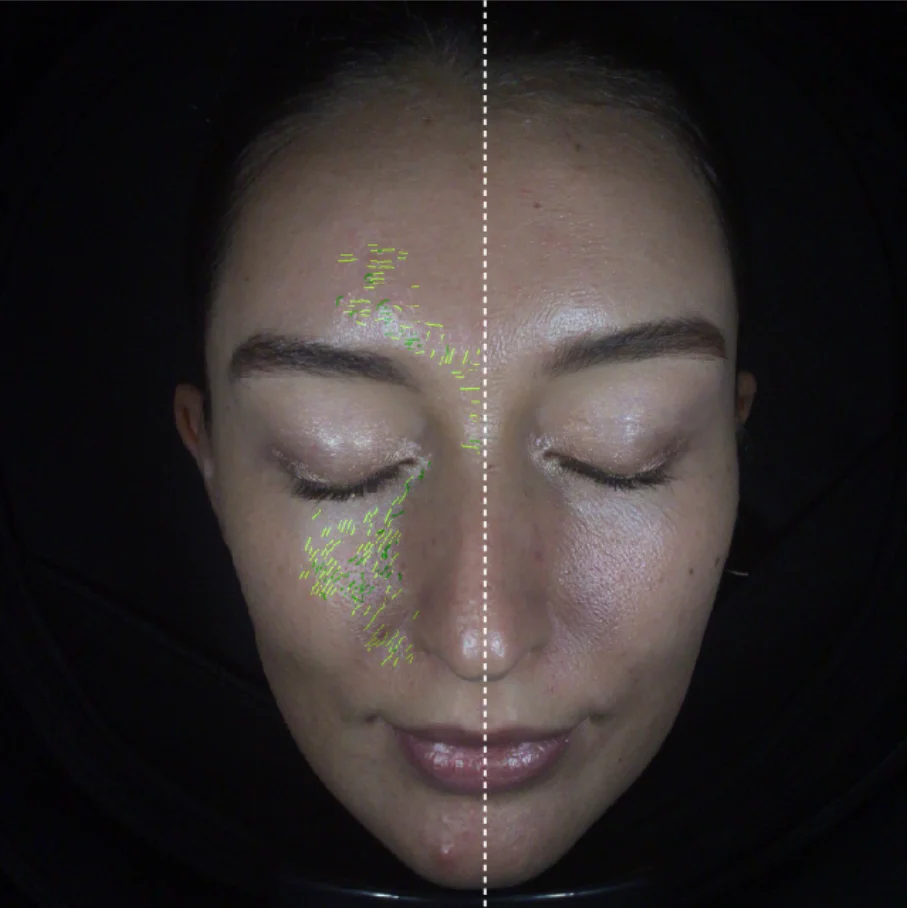 MEICET MC10 Skin Analyzer - Professional Facial Care Tool