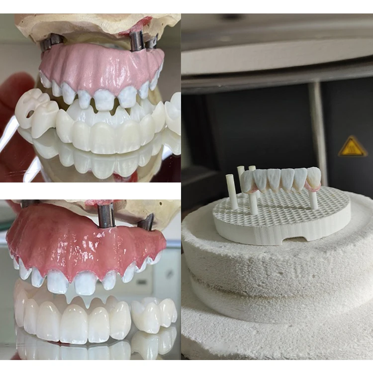 ZETIN Dental Porcelain Furnace with Vacuum Pump - Accurate Temperature ...