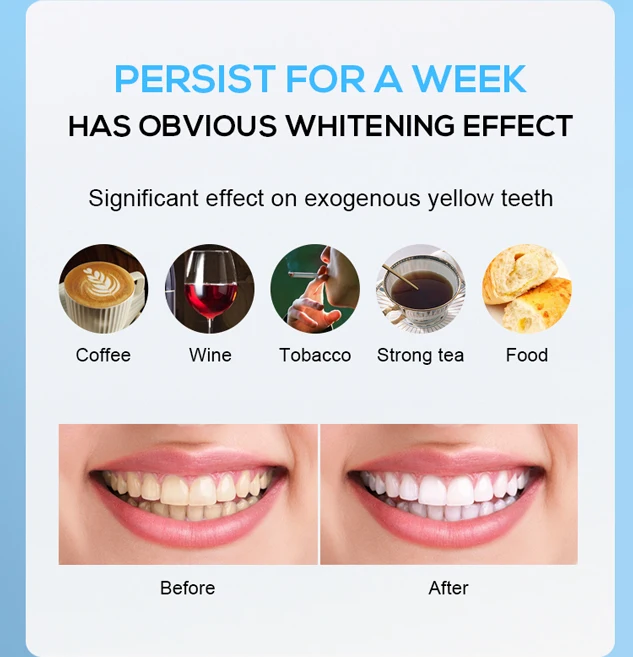 Best Professional Removes Stains Safely Dental Teeth Whitening Advanced ...