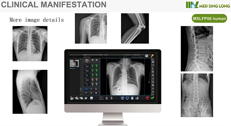 Iray Medical X-Ray Equipments & Accessories - Digital X Ray Machine ...