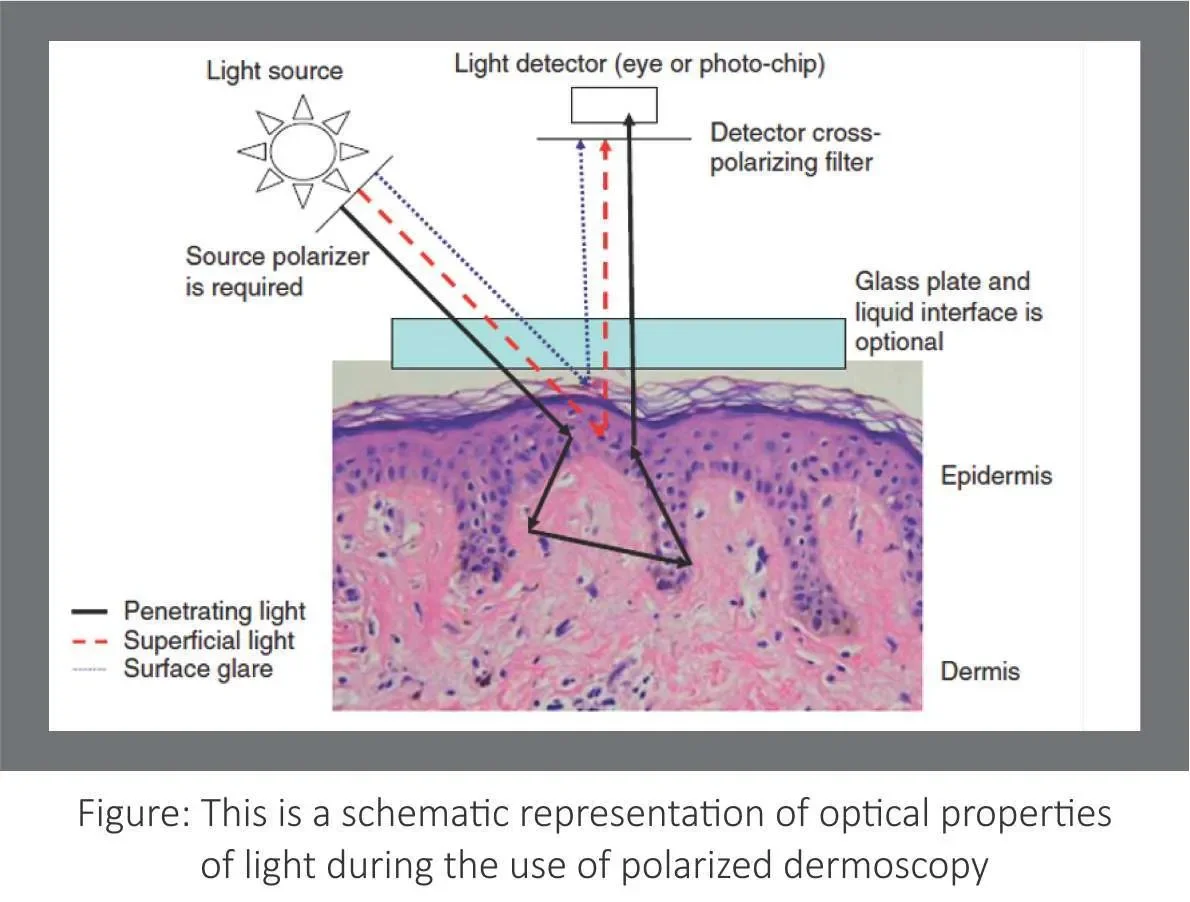 IBOOLO DE-400 Electric Dermatoscope With Both Nonpolarized and ...