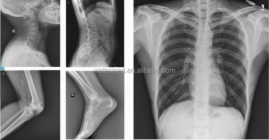 All in One X-ray Screening System/Portable X Ray Machine Medical Mobile ...