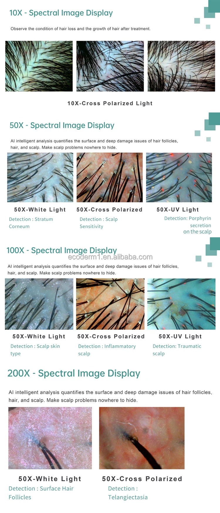 Hair Analysis Scalp Microscope Detector Skin Care Analyzer Scalp ...