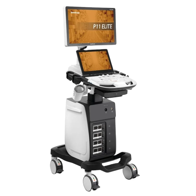 SonoScape Ultrasound Machine 4D/SonoScape Ultrasound Portability AVC ...