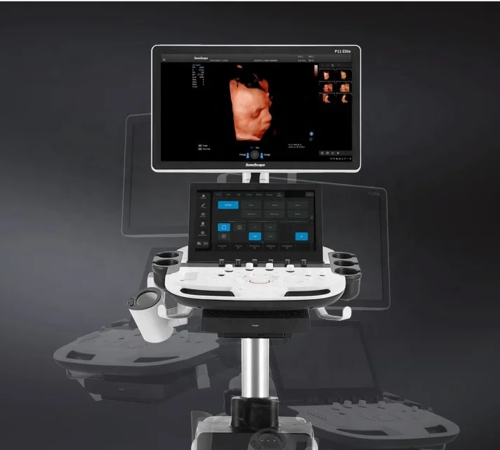 SonoScape Ultrasound Machine 4D/SonoScape Ultrasound Portability AVC ...