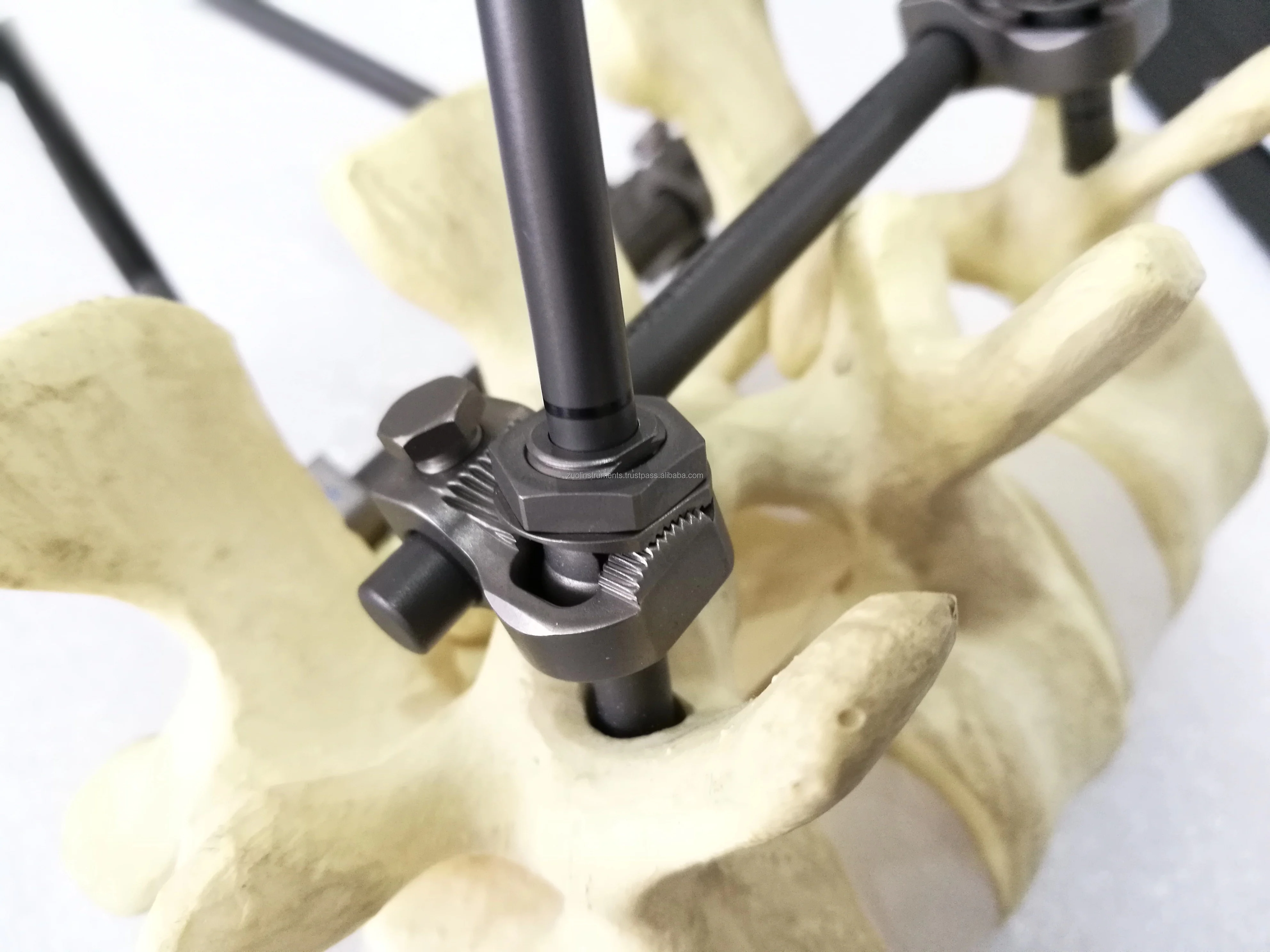 Cervical Intervertebral Fusion Cage System Peek Orthopedic Implant For ...