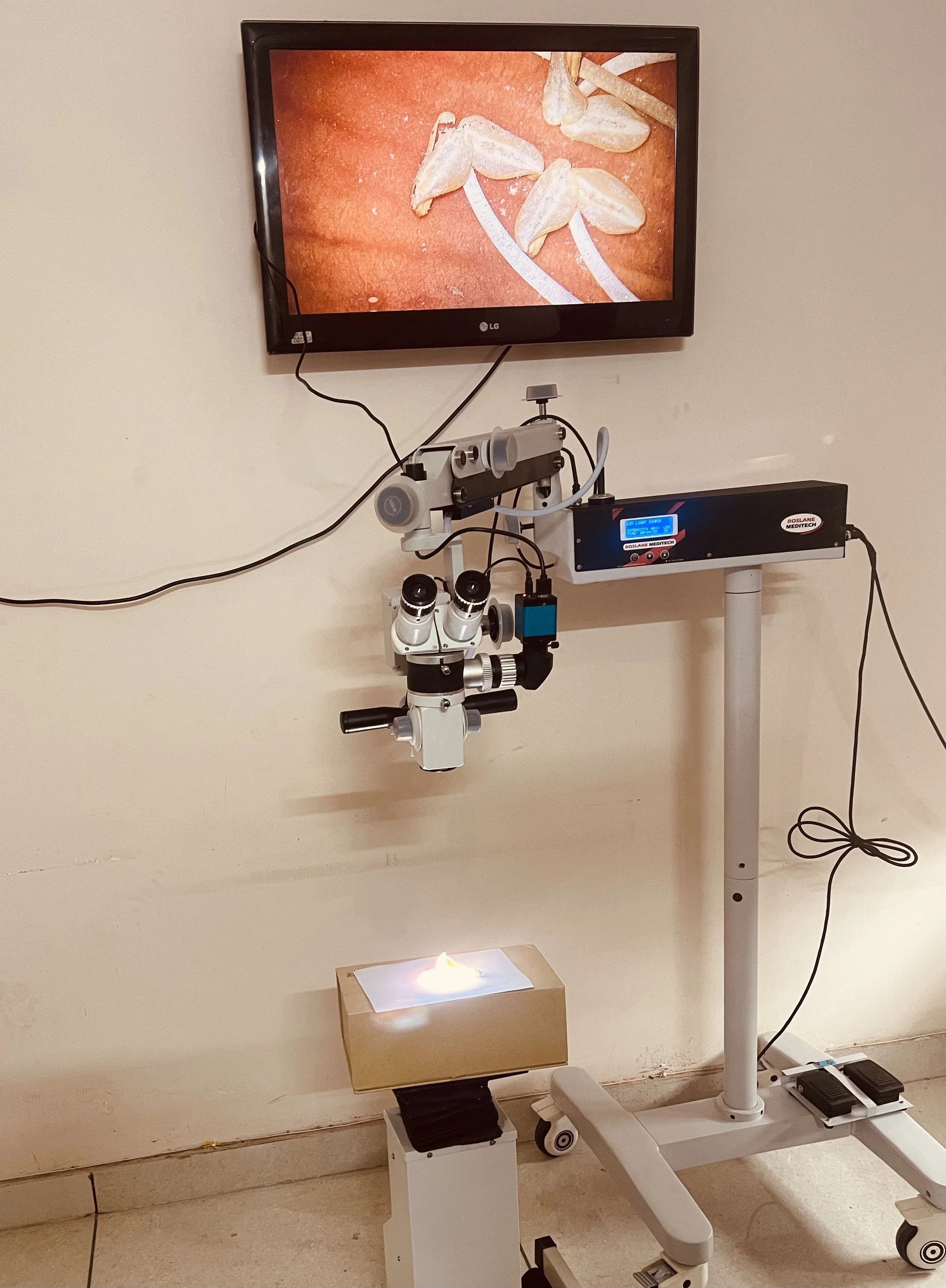 Wet Lab Ophthalmic Eye Operating Surgical Microscope Prices