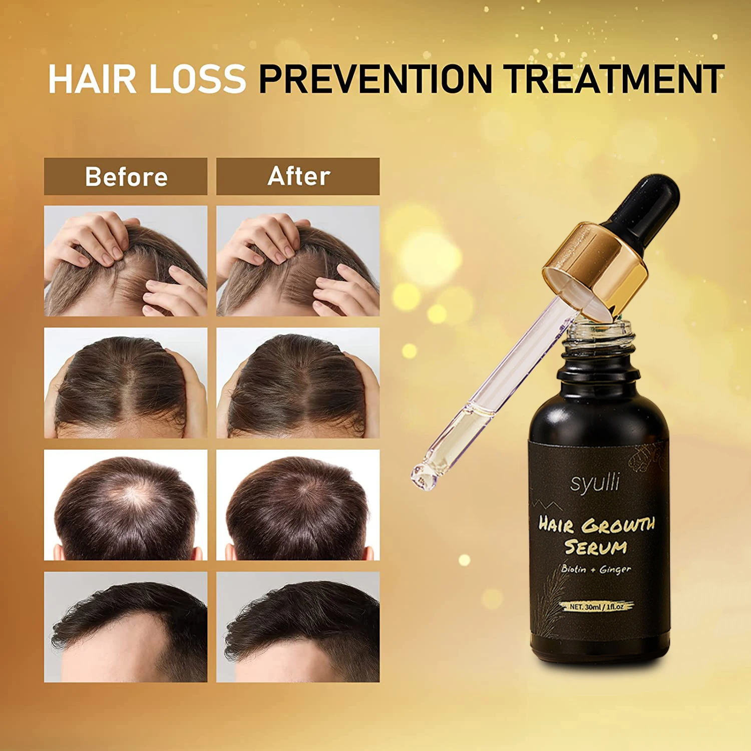 Advanced Follicle Boost Hair Density Serum - Organic Growth