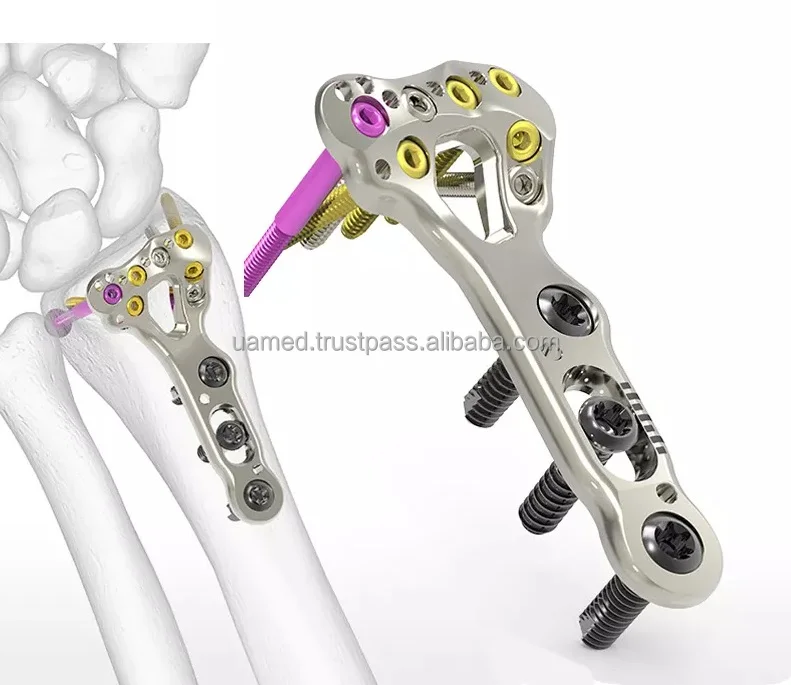 3.5mm Locking Straight Reconstruction Plate Radius Plate Holes Matte ...