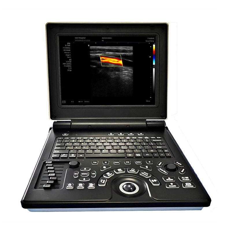 MN-E20 Diagnostic Ultrasound System 3d 4d ultrasound Imaging Color ...