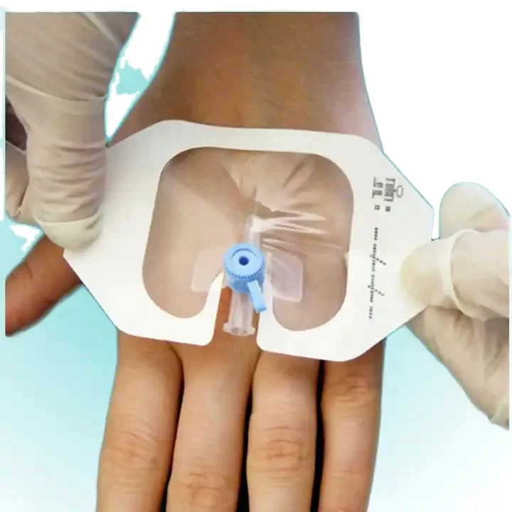 Medical Iv Cannula Fixation Dressing Disposable Transparent Waterproof ...