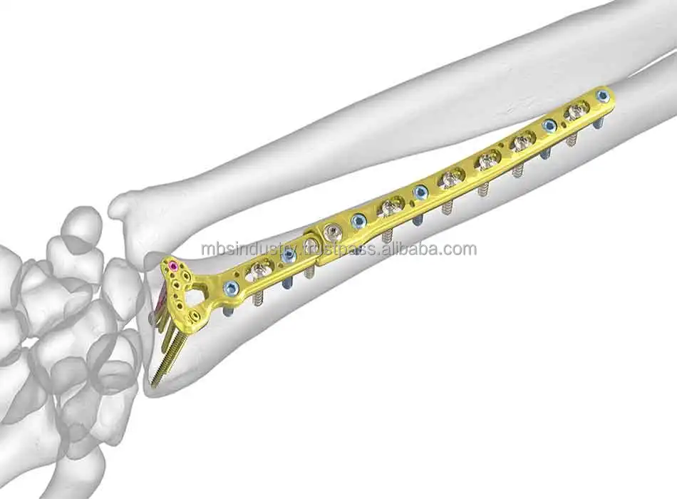 Titanium Implants Plates For Orthopedic In Food Grade And Best For ...