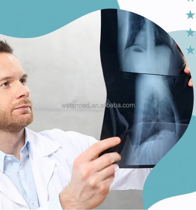 All in One X-ray Screening System/Portable X Ray Machine Medical Mobile ...