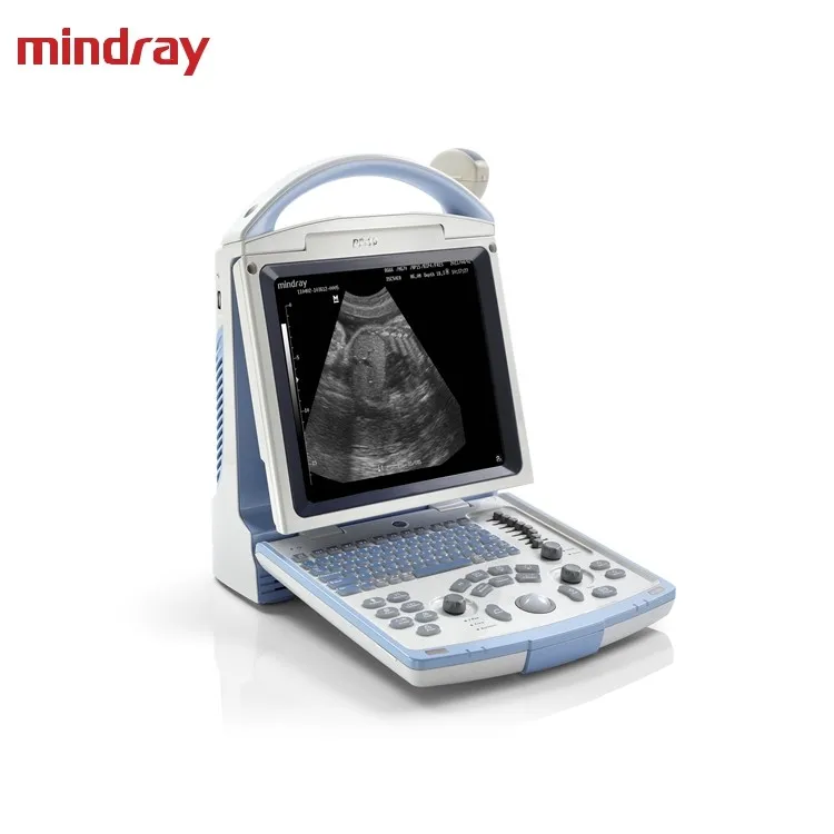 Mindray Equipment Portable Ultrasound System Mindray Dp 10 Ultrasound ...