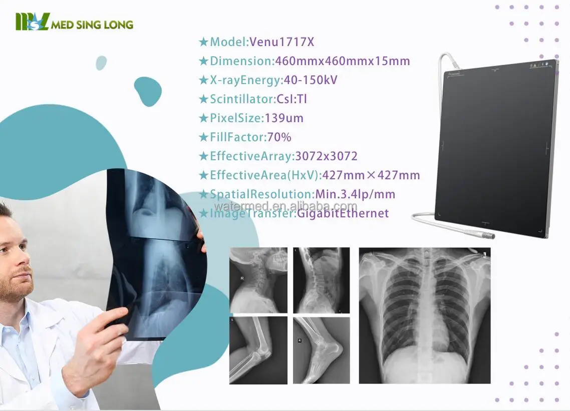 All in One X-ray Screening System/Portable X Ray Machine Medical Mobile ...