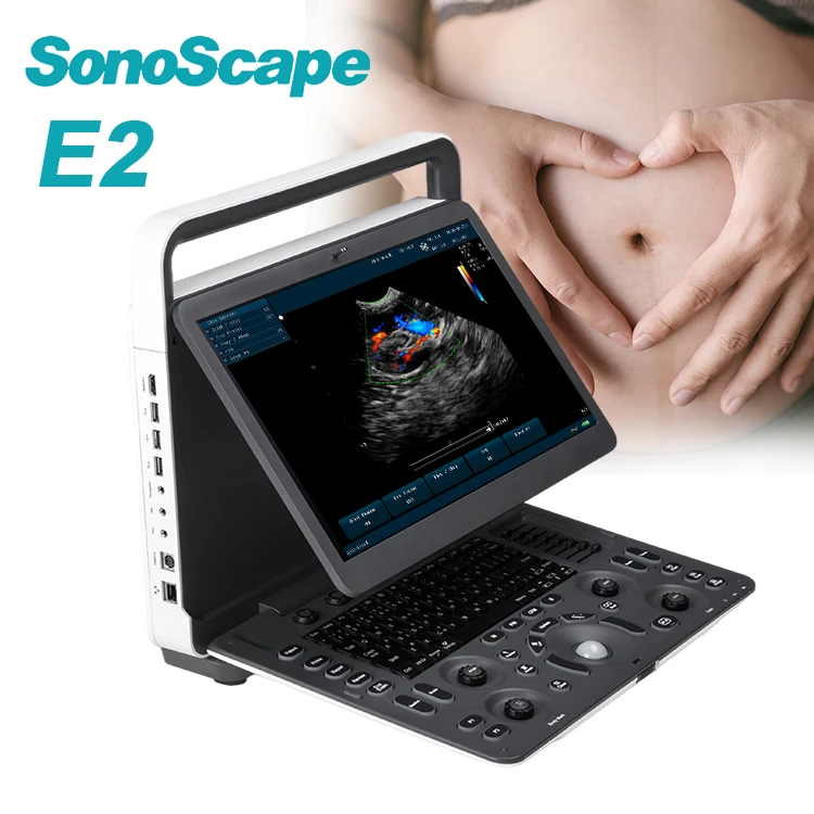 Sonoscape E2 Portable High Resolution Color Doppler Ultrasound Machine ...