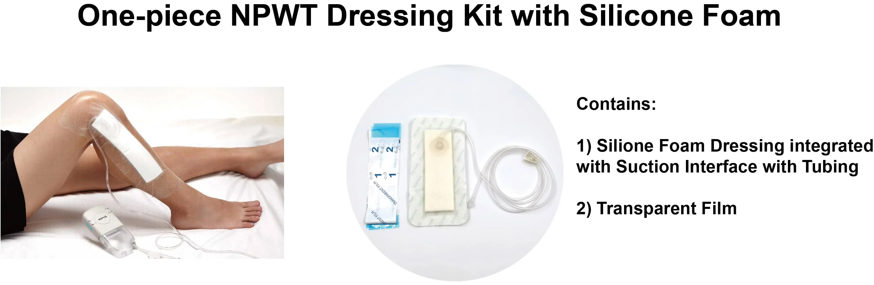 Trummed Negative Pressure Wound Therapy Dressing NPWT Dressing Kit with ...