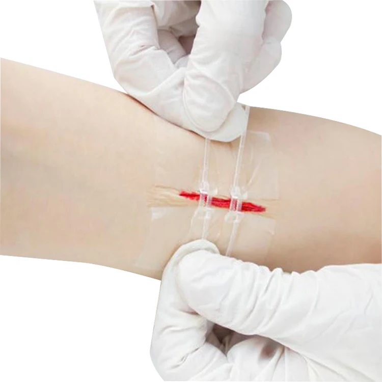 BLUENJOY Medical Transparent Zip Stitch Dressing Zipper