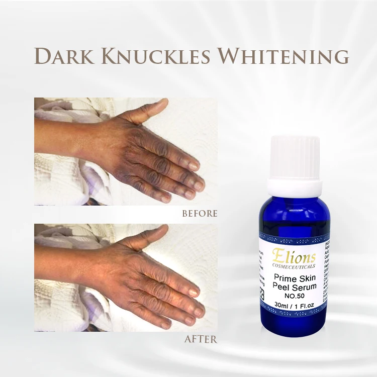 50% Prime Skin Peel Acid - Whitening Serum for Body & Face