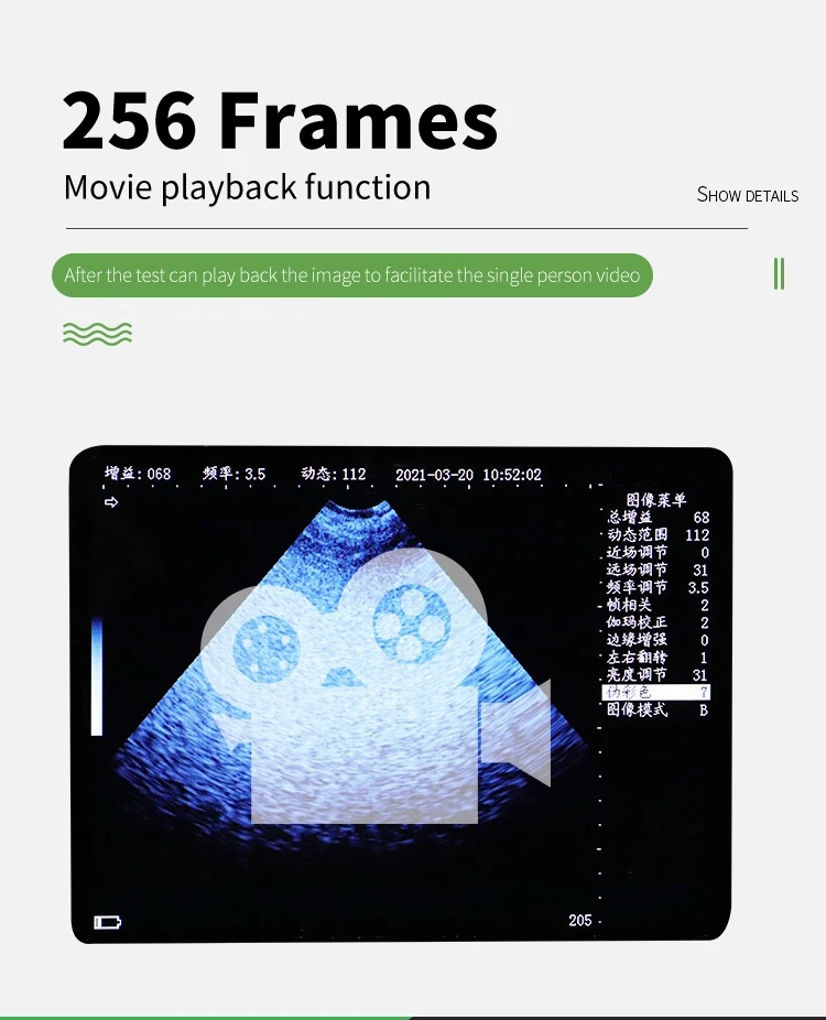 12.1 Inch Led Screen Factory Provide Electronic Convex Array Probe ...