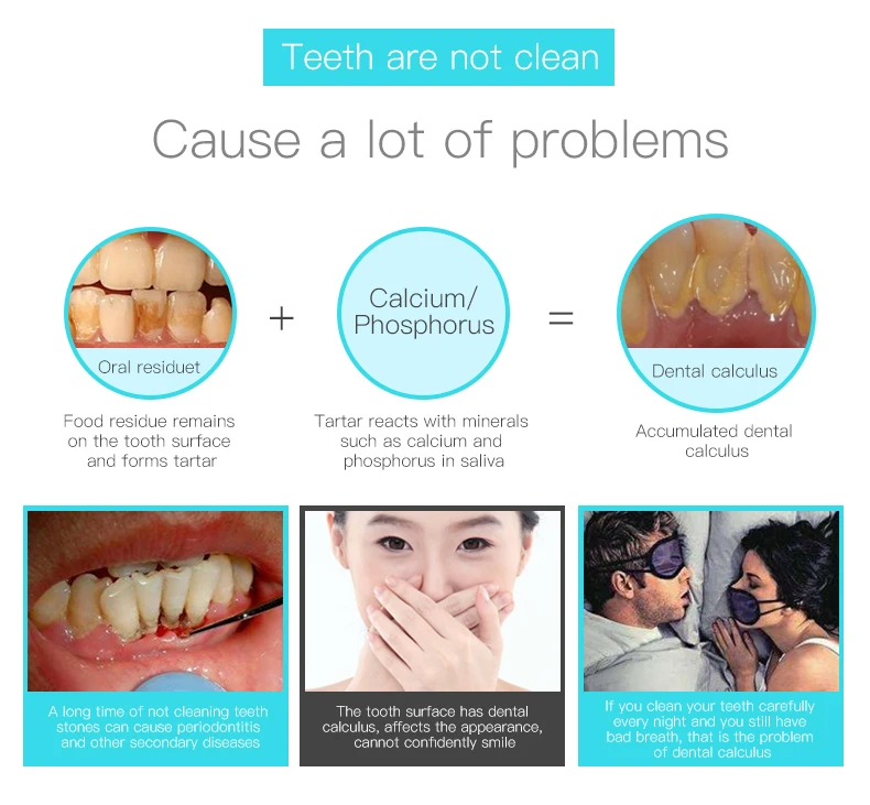 Sanzuwu Penghilang Kalkulus Gigi Best Oral Teeth Whitening Tool Water ...