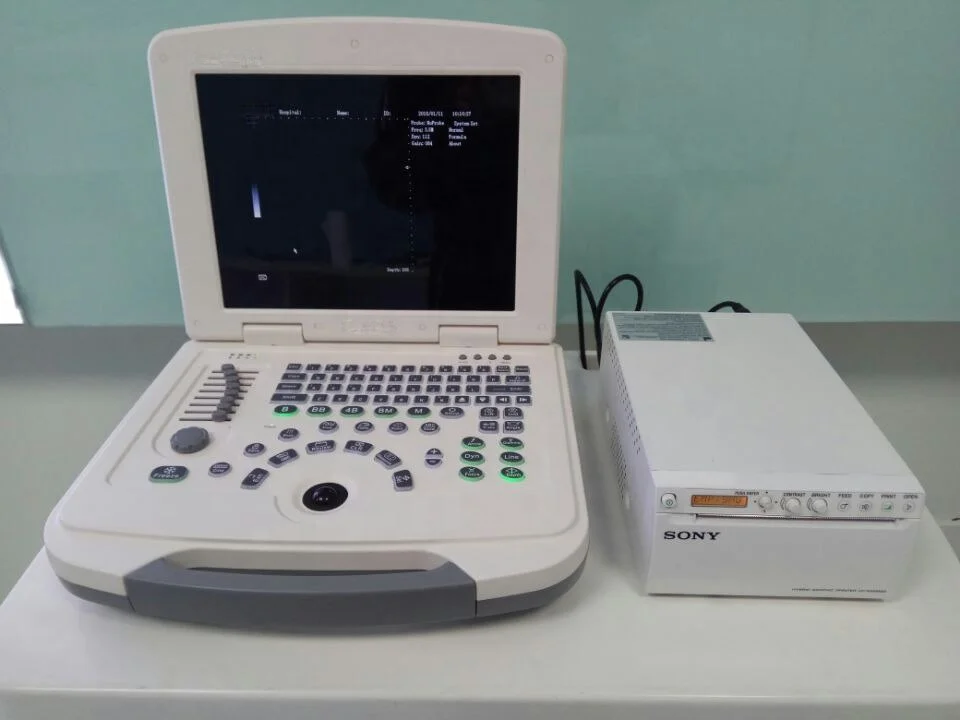 【ポータブル】 在庫あり!!! ポータブル超音波マシン、人間用エコーグラフマシン - Buy Echograph,Portable ...
