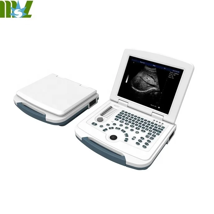【ポータブル】 在庫あり!!! ポータブル超音波マシン、人間用エコーグラフマシン - Buy Echograph,Portable ...