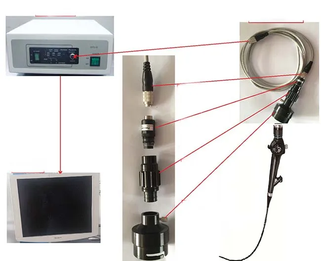 Flexible Nasal Endoscope,Disposable Endoscope,Portable Ent Endoscopio ...