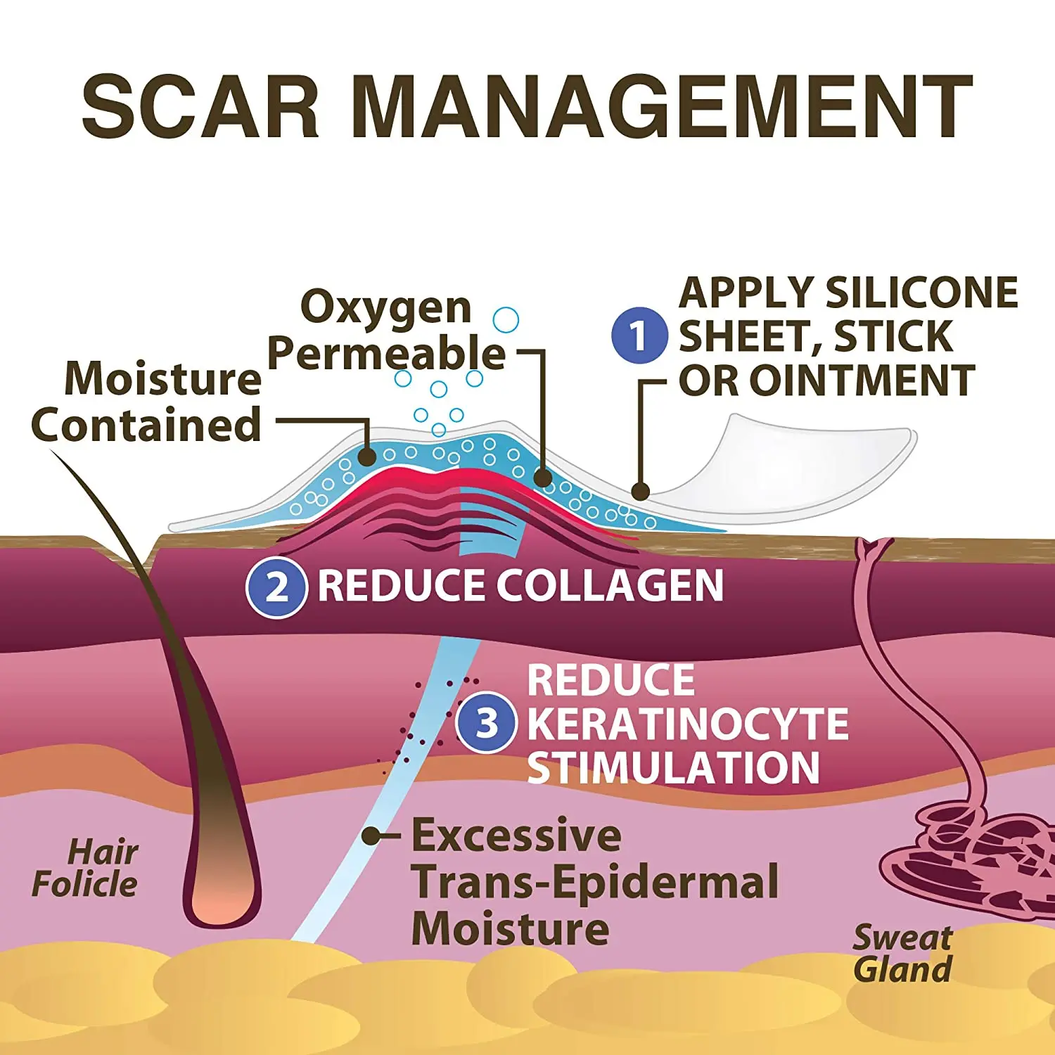 Bluenjoy Medical Silicone Scar Sheets Anchor Shape Breast Scar Remover ...